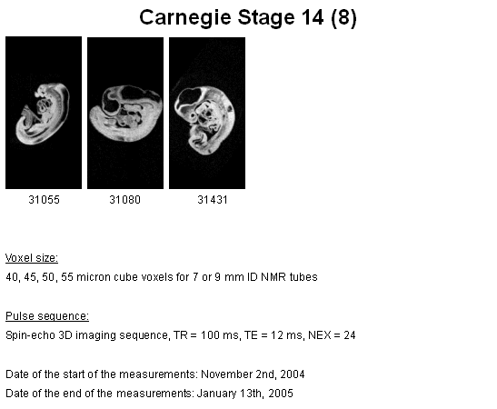 Carnegie Stage 14