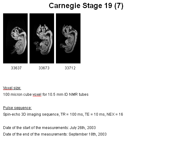 Carnegie Stage 19